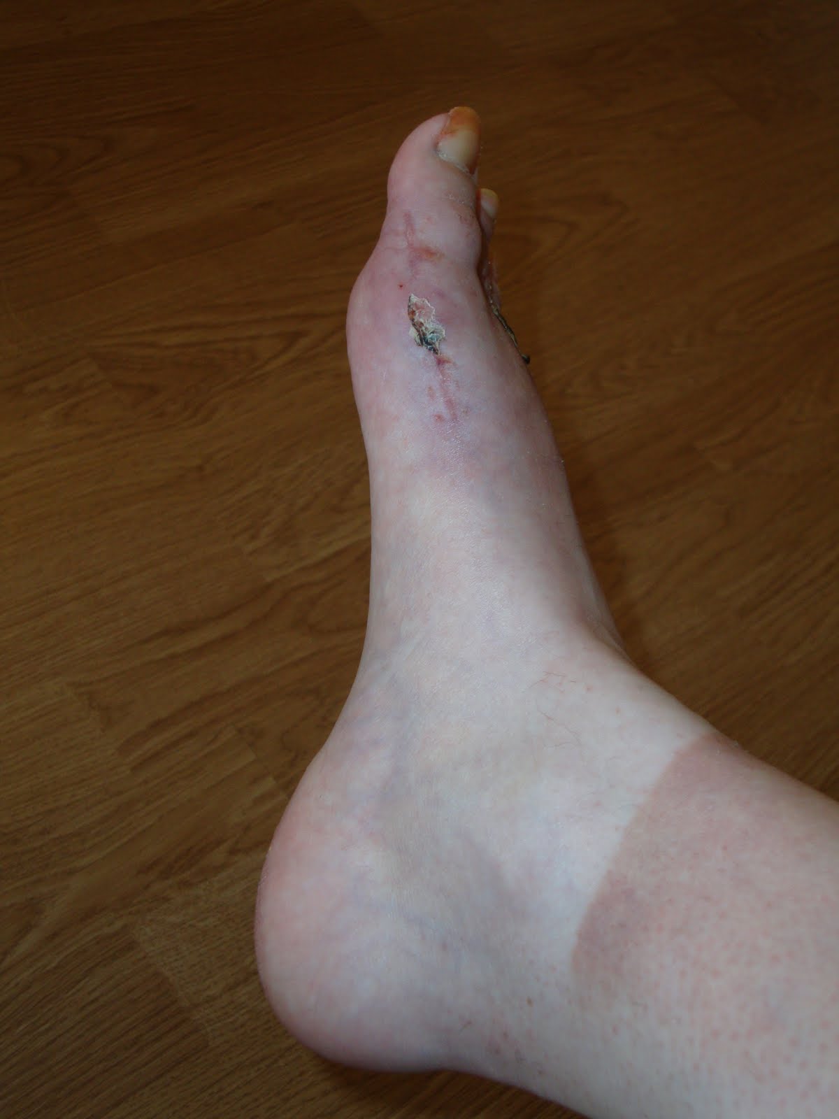 Gwen's Feet (and Hand): Week Nine Roundup