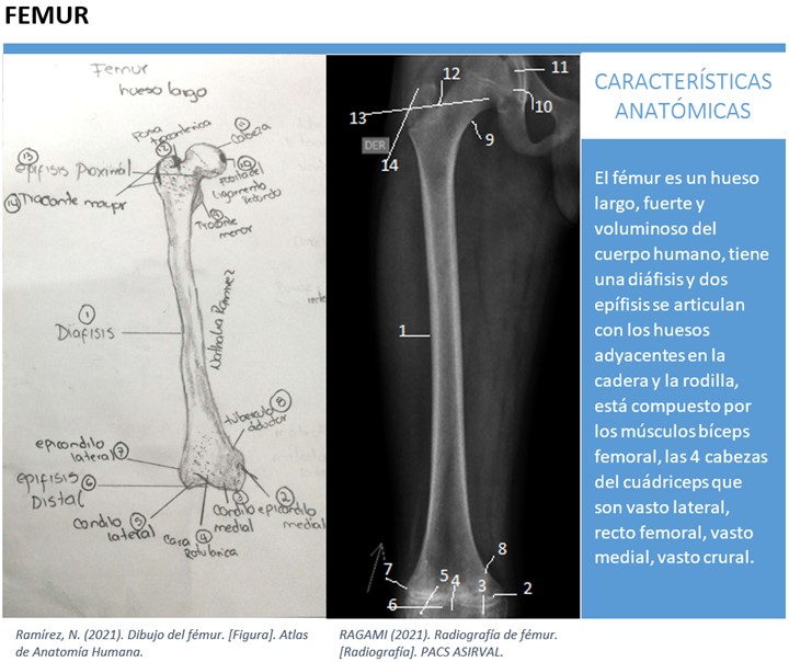 Tarea 2 Conceptualización Anatómica.
