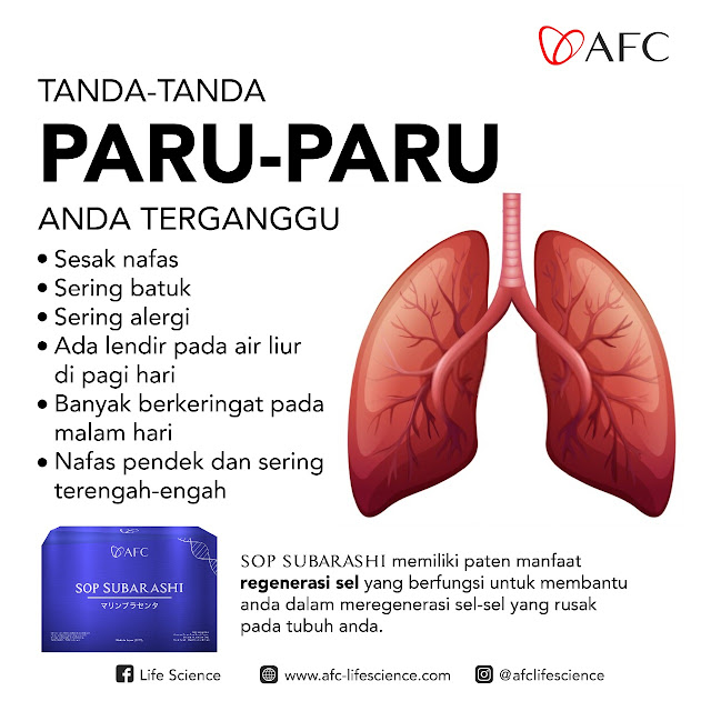 APA PATENT DAN FUNGSI SOP SUBARASHI - BISNIS AFC RAMSINA - Perusahan ...