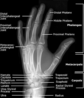 Teknik pemeriksaan X Ray Manus - Seputar Kesehatan