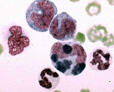 Infection Landscapes: Ehrlichiosis