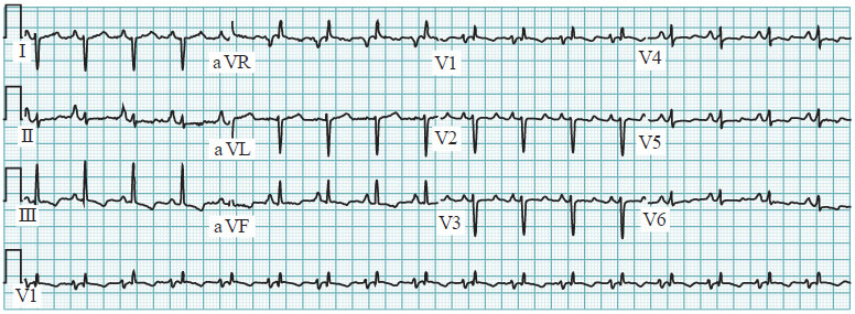 Cardiology Pulmonary Hypertension Case File