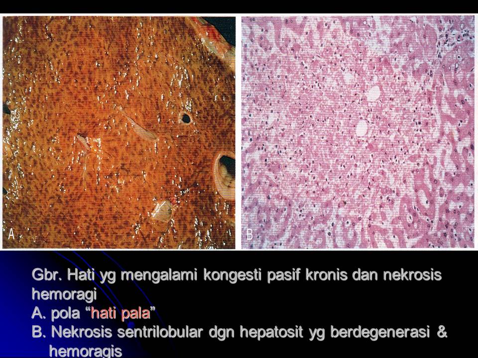 Reza Aditya Digambiro: HIPEREMIA DAN KONGESTI