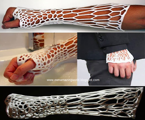 Amazing World: The Future Of Medical Orthopedic Cast