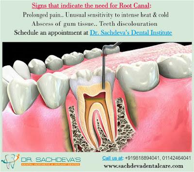 Root Canal Treatment: Repairing a Fractured or Broken Tooth