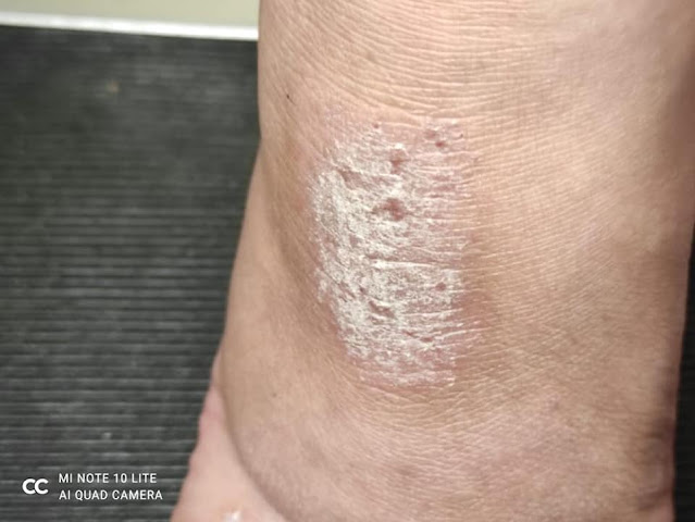 EL RINCÓN DE LA MEDICINA INTERNA. juanpedromacaluso@yahoo.com.ar: MUJER ...