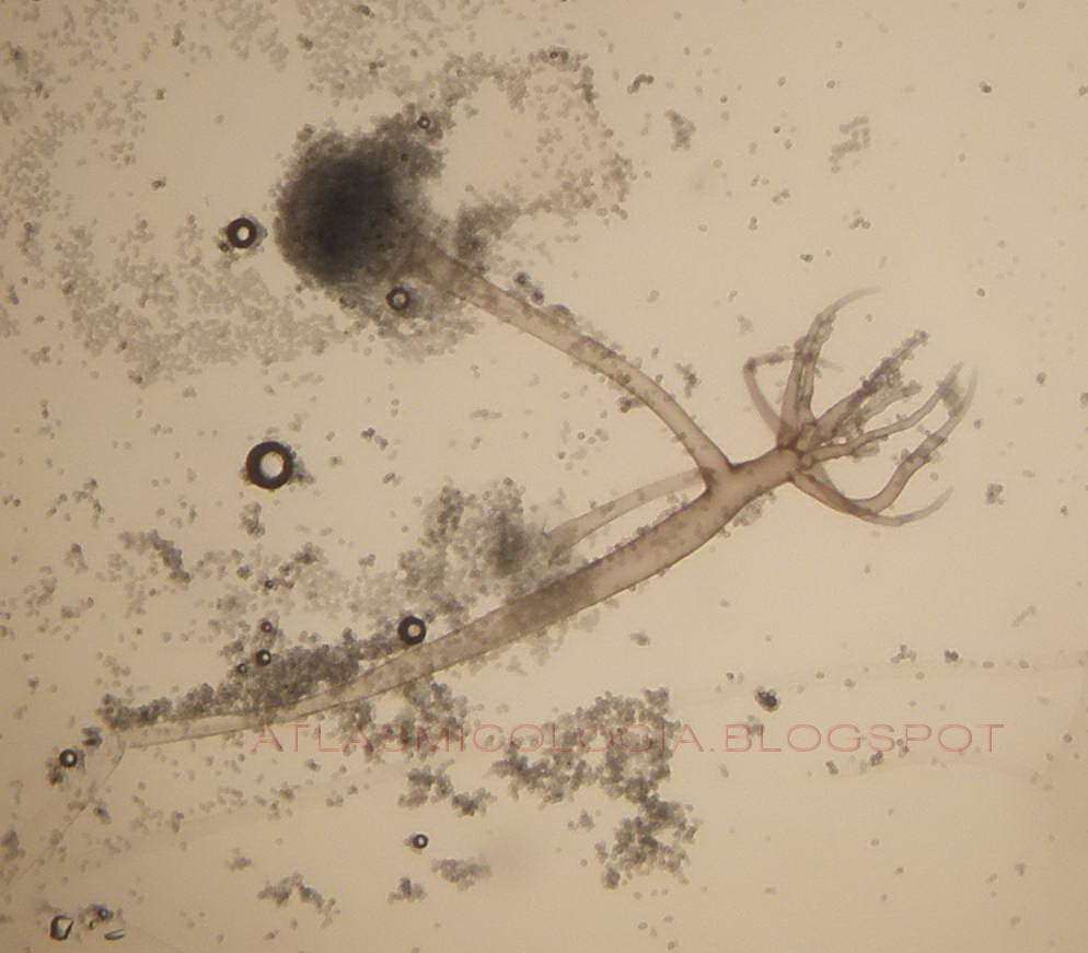 ATLAS MICOLOGIA: RHIZOPUS SP.