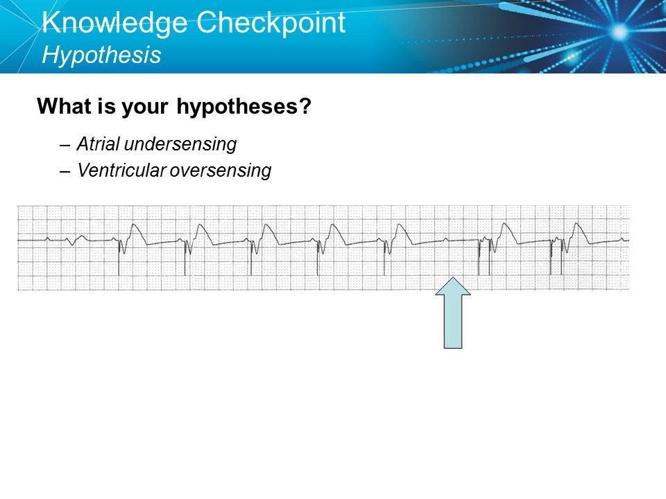 CVT Mohd Farid: Pacemaker Follow Up Part I-Medtronic Academy