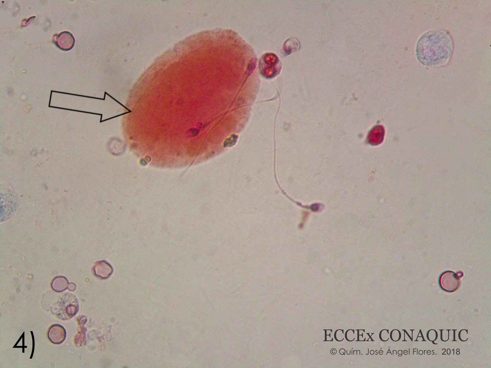 Examen General de Orina: enero 2018