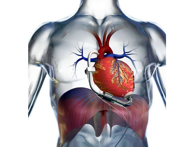 Imágenes del corazón humano