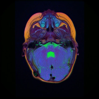 Nevit's blog: Color MRI of the BRAIN