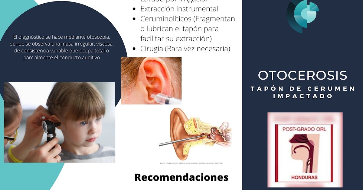 ¿Necesitas ayuda? Otorrinolaringología información para pacientes