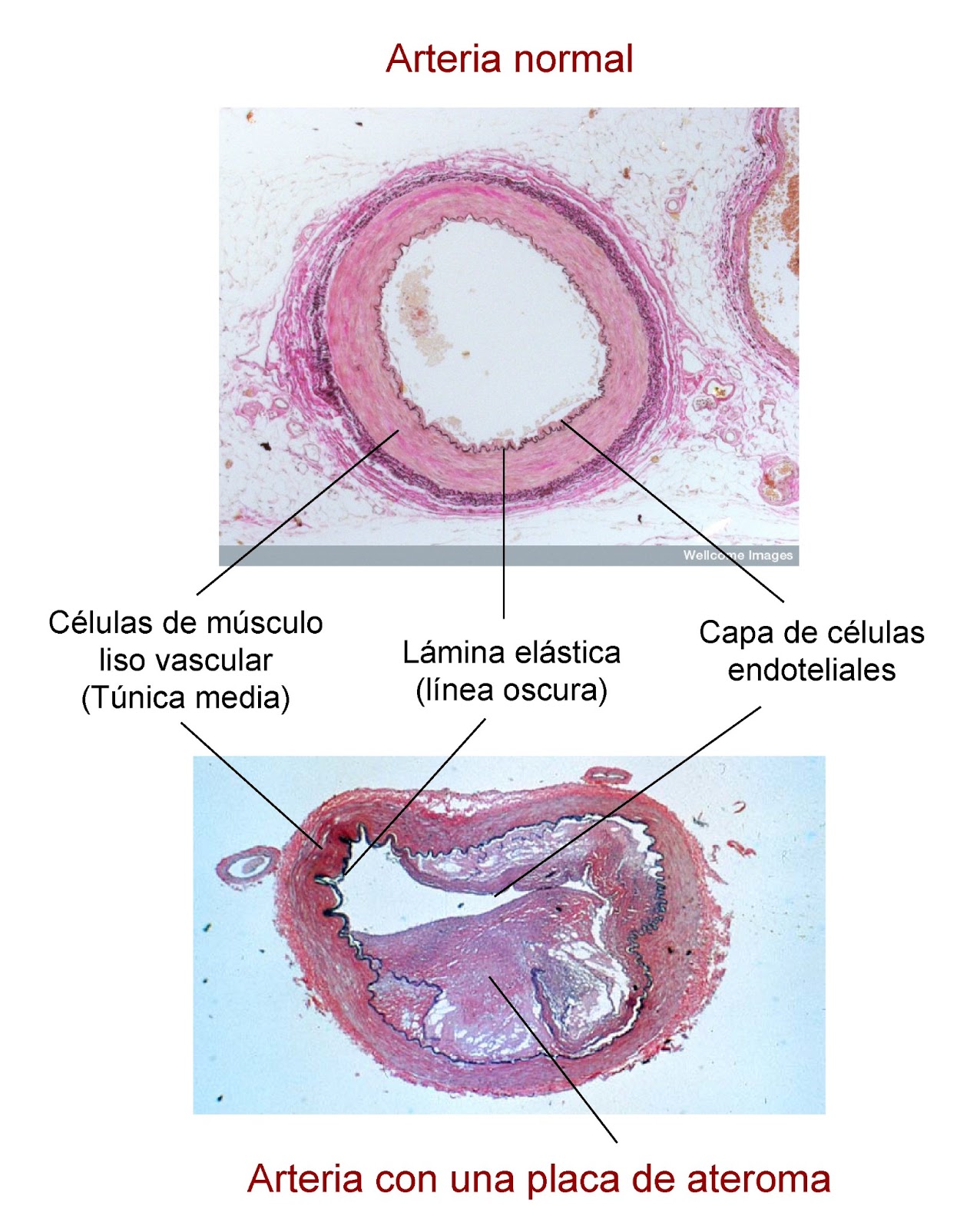 Hormonas : COLESTEROL I. Tipos y su relación con la salud