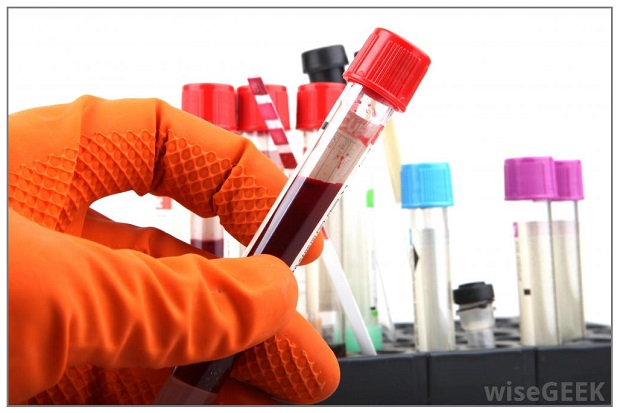 Método criado por brasileiros facilita descoberta de marcadores para ...