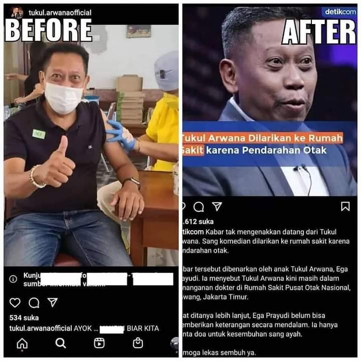 HEBOH... Belum Lama Divaksin, Tukul Arwana Alami Pendarahan Otak ...