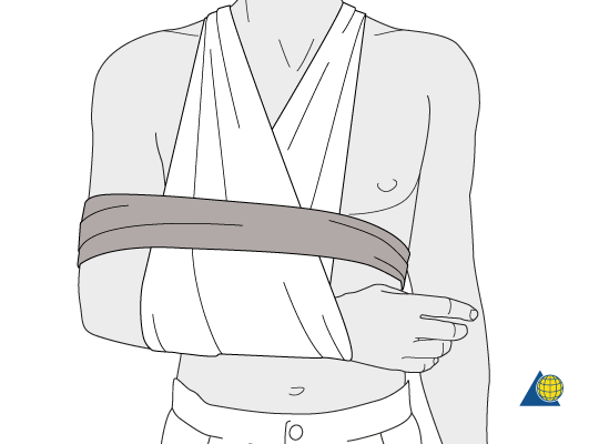 ER goldbook: Approach to orthopedic trauma