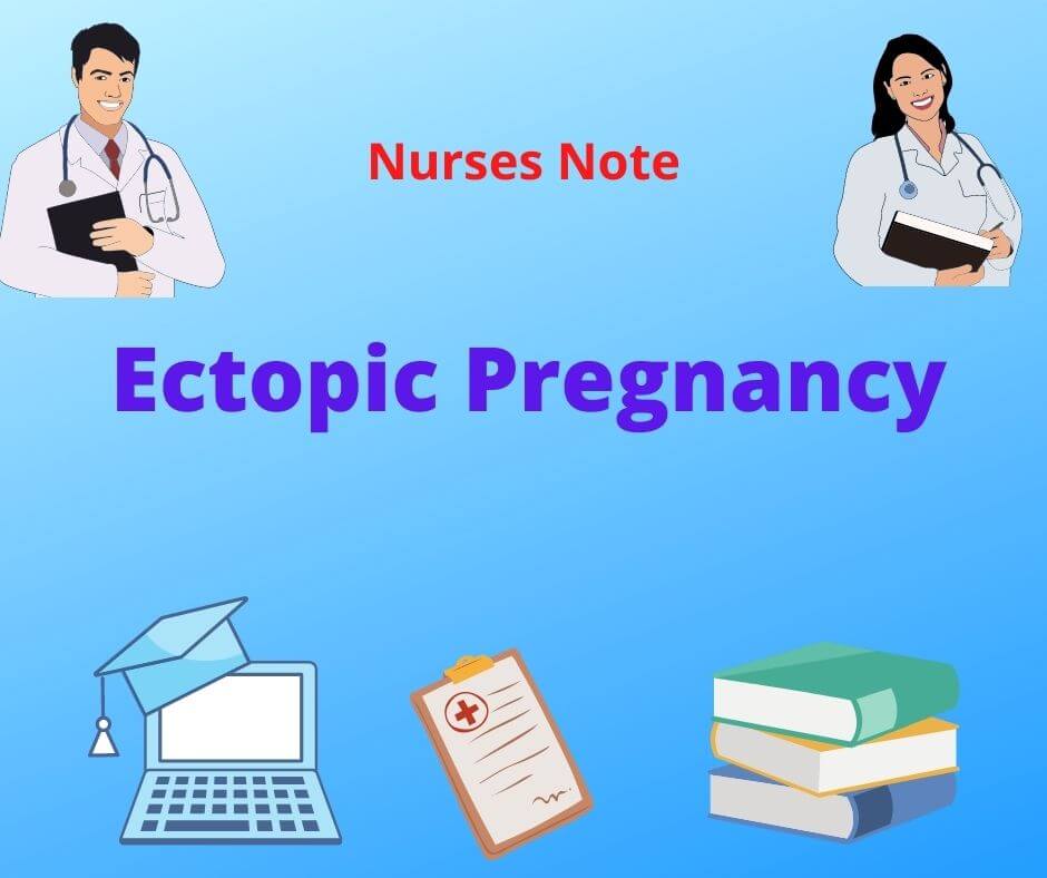 Ectopic pregnancy: Causes, Symptoms, Diagnosis, and Complications ...