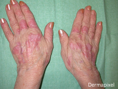 Dermapixel: mayo 2021