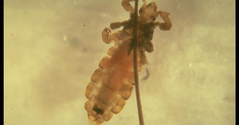 An Entomologist's Perspective on Lice