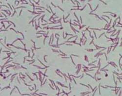 Symptoms Causes and Cures: Campylobacteriosis