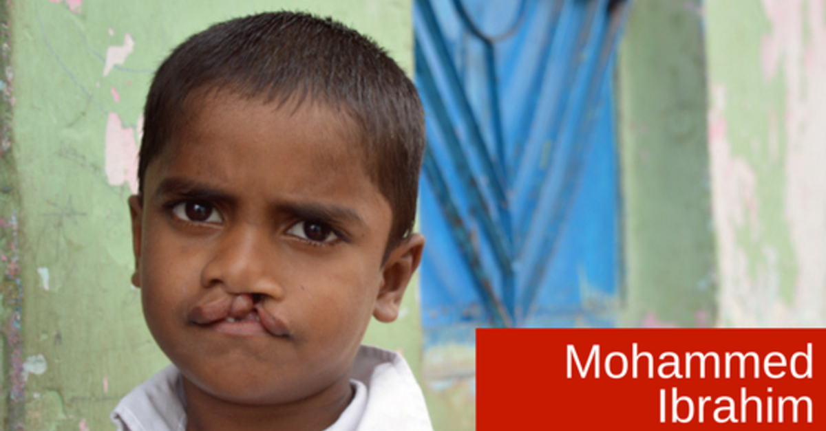 Welcome to EduledgeAsia : Story of cleft children- Ibrahim and Mehrin