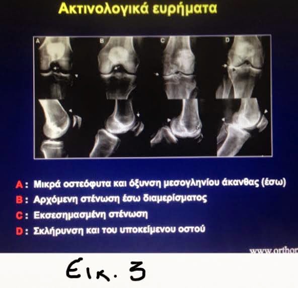 Dr. Salonikidis Panagiotis: ΟΑ ΓΟΝΑΤΟΣ