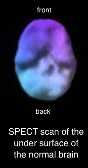 Under Much Grace: Cognitive Dissonance in Confrontation and the Process ...