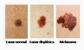 Pecas y Lunares ~ Homeostasis 3.0