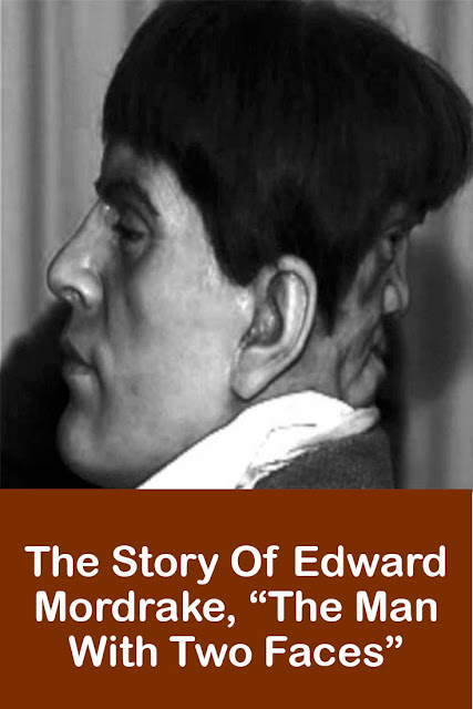 The Story Of Edward Mordrake, “The Man With Two Faces”