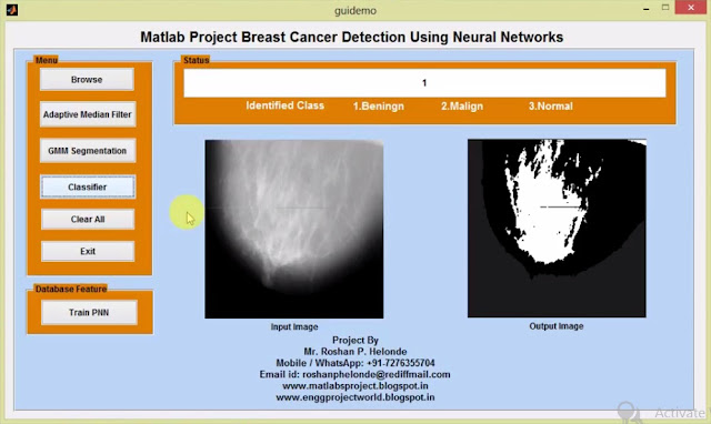 Matlab Project With Source Code Breast Cancer Detection