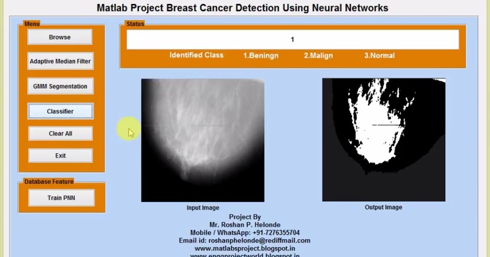 Matlab Project with Source Code Breast Cancer Detection Using Neural ...