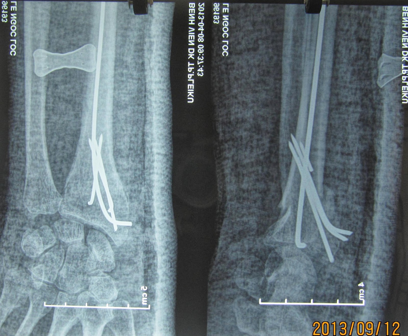 MY LOVE2009: KIM KIRSCHNER GÃY TRONG LÒNG TỦY