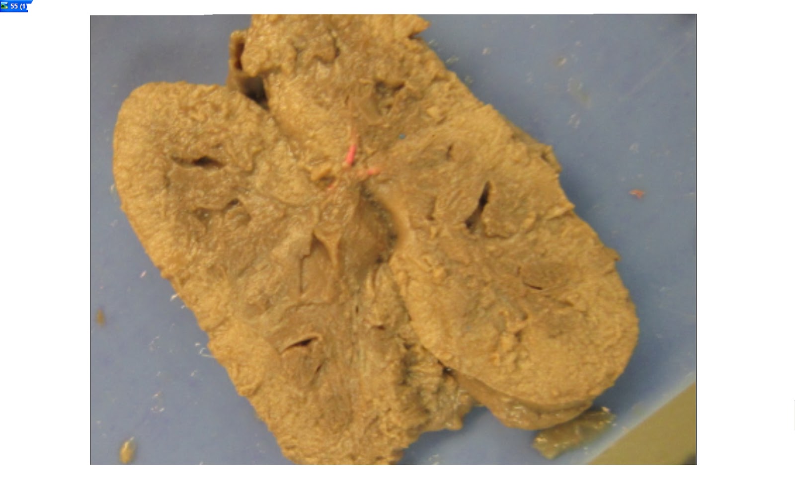 Biology Disection Project: Pig Disection: Excretory System