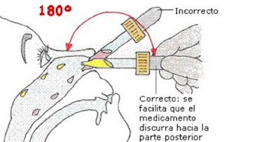 ADMINISTRACIÓN DE MEDICAMENTOS VIA NASAL