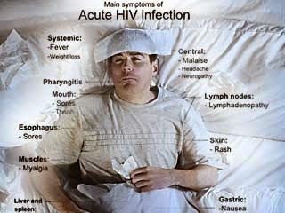 HIV (A Blood-borne Disease): SIGNS AND SYMPTOMS OF HIV