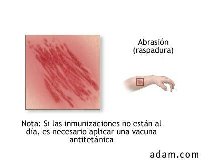 PRIMEROS AUXILIOS: mayo 2012