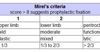 .: Mirels Criteria