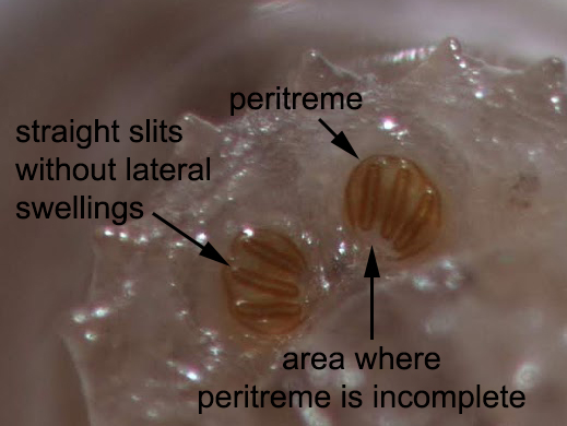 Creepy Dreadful Wonderful Parasites: Answer to Case 591