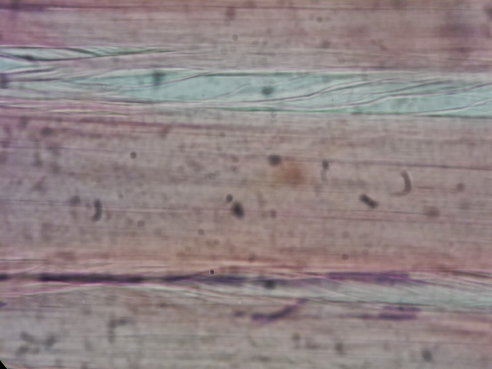 Ourlad's Paradigm: Connective Tissue