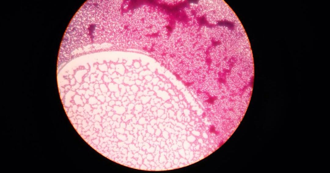 experiment 4: Microscopic examination of stained cell preparation and ...