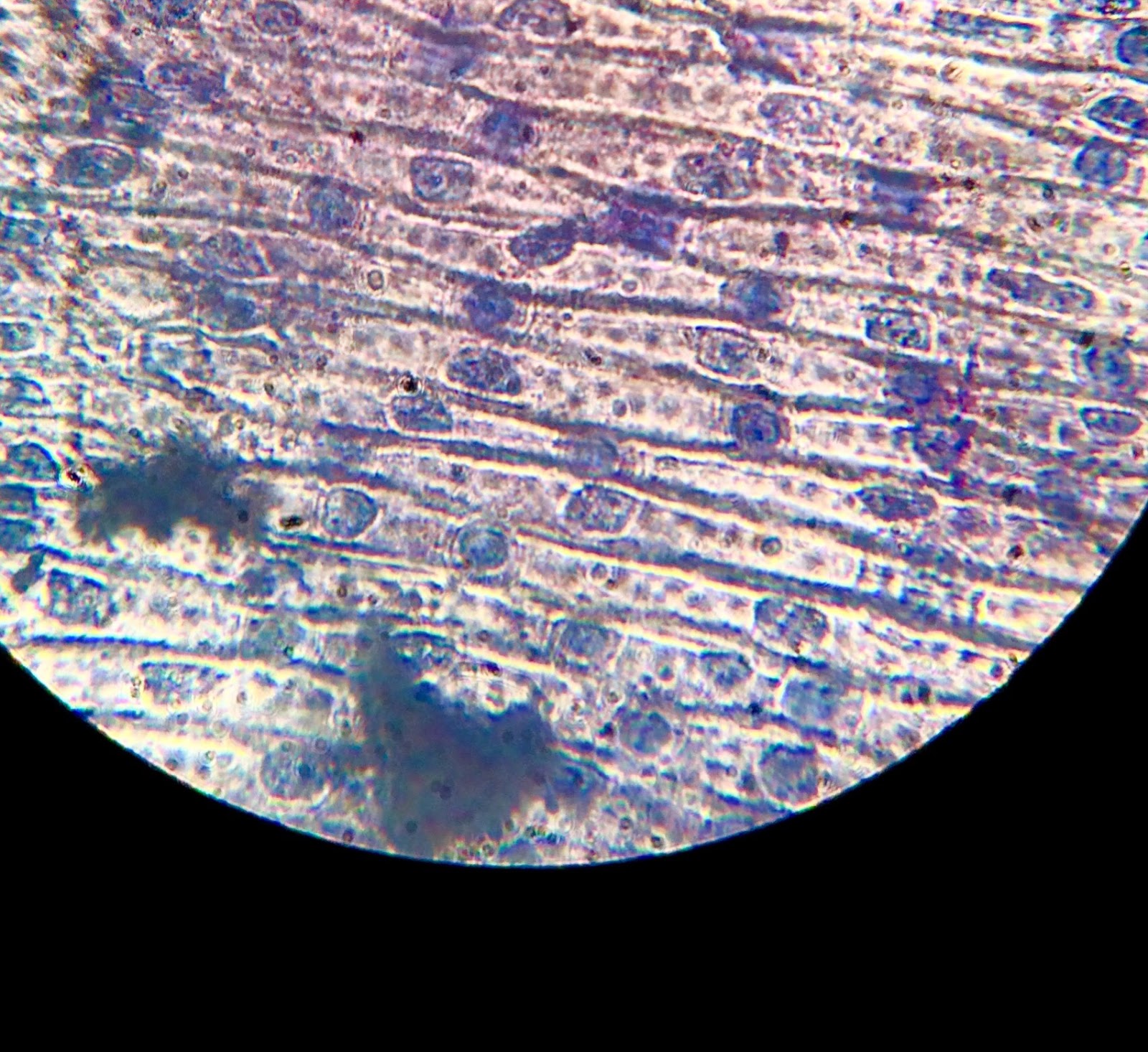 OBSERVACIÓN DE LOS TEJIDOS EPITELIAL DE REVESTIMIENTO EN LA BOCA Y ...
