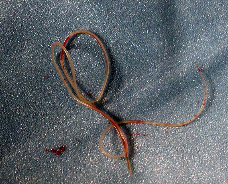 MENGENAL JENIS-JENIS CACING PARASIT YANG SERING MENGINFEKSI MANUSIA ...