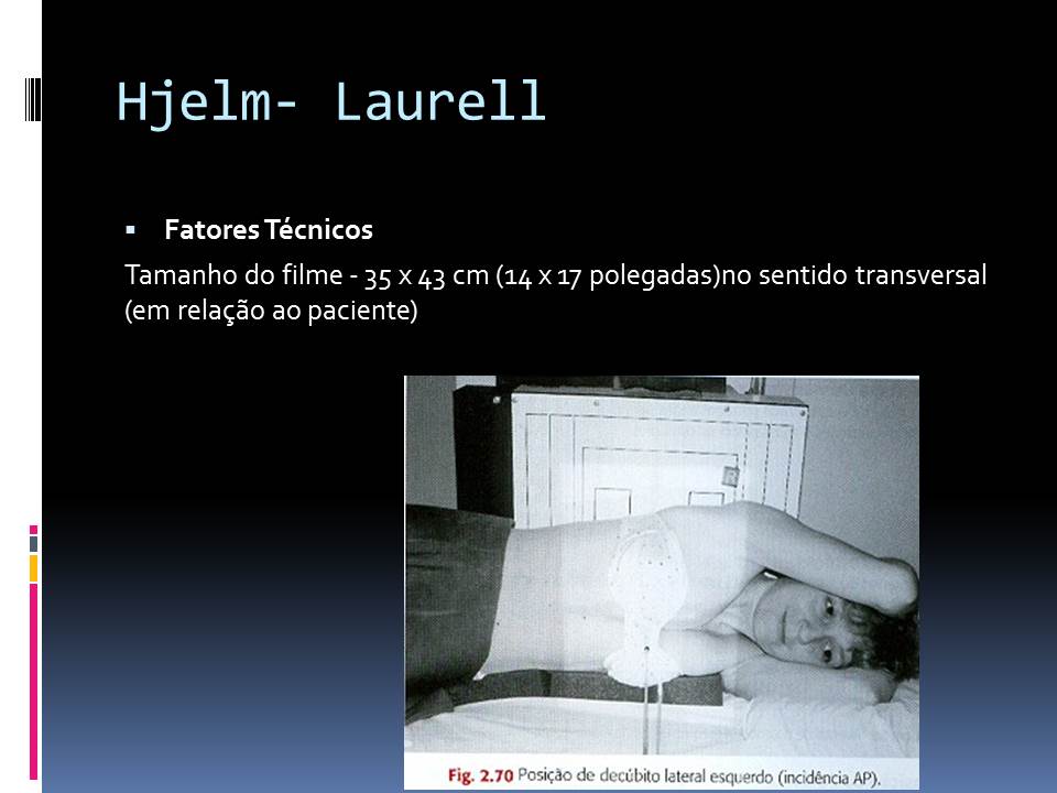 Radiologia Dinâmica: Hjelm Laurell - Exame Especial de Tórax
