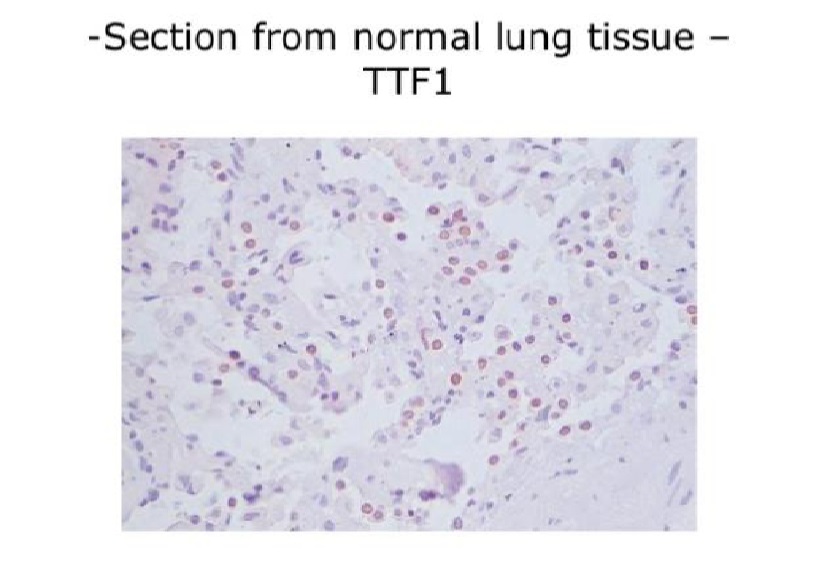 What is Immuno Histo Chemistry? How to search IHC Laboratory for ...