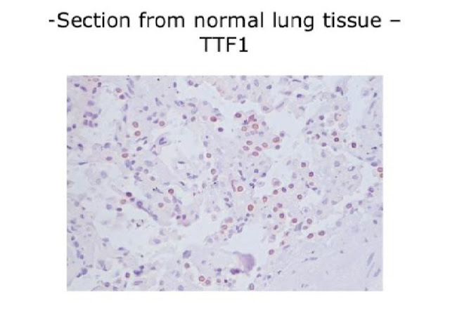 What is Immuno Histo Chemistry? How to search IHC Laboratory for ...