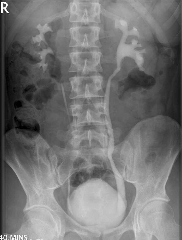 examination-intravenous-pyelogram-radiology-health