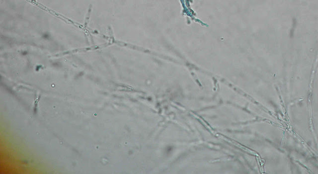 ATLAS MICOLOGIA: TRICHOPHYTON SOUDANENSE