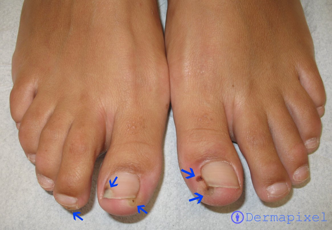 Dermapixel: abril 2011