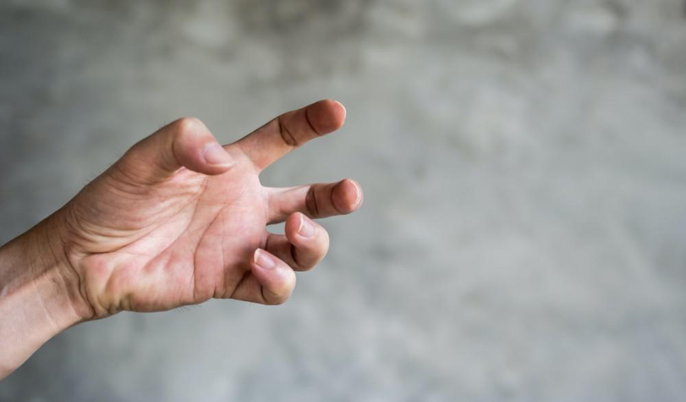 Segawa Syndrome - Cause, Symptoms, Diagnosis and Treatment Options You ...