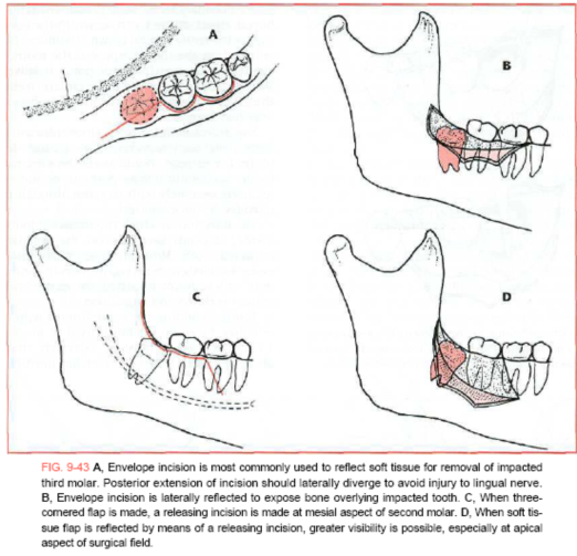 Teknik Odontektomi Kedokteran Gigi | Dokter Gigi